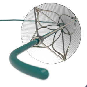 Enhancing Catheter Steerability and Deflection - Medical Murray