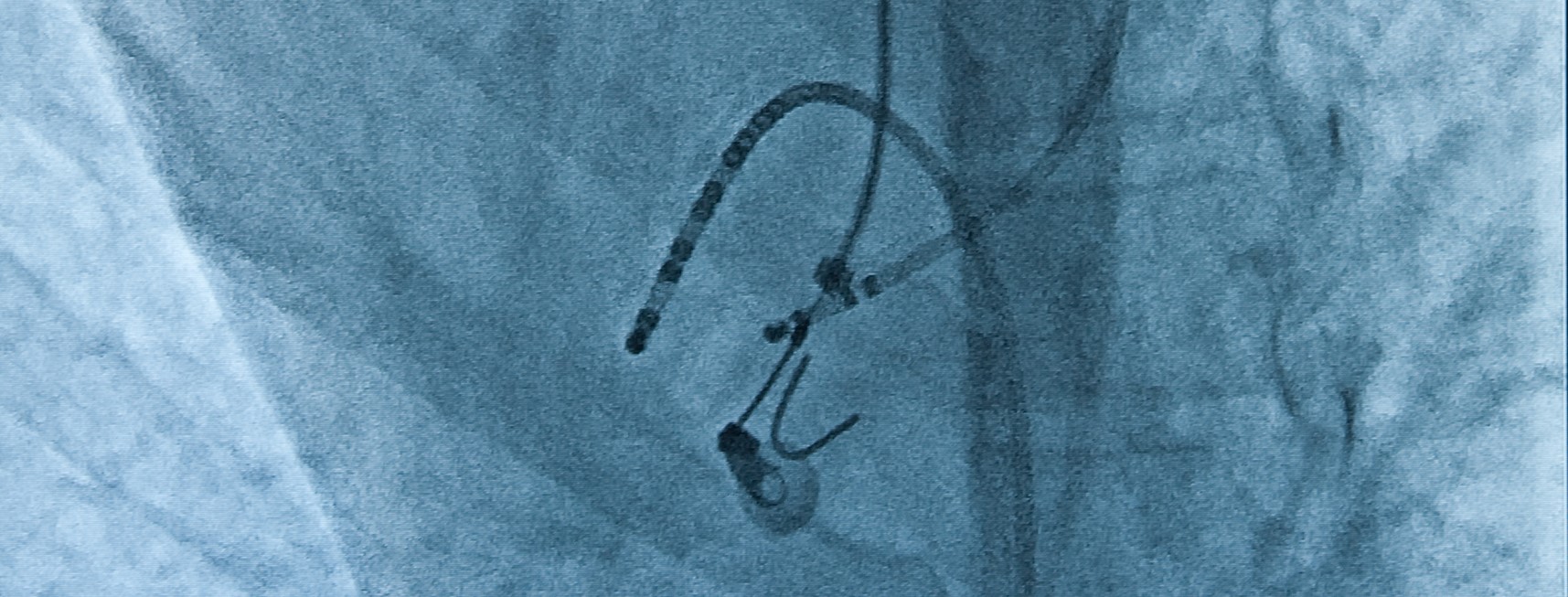 Radiopacity Testing Services - Medical Murray