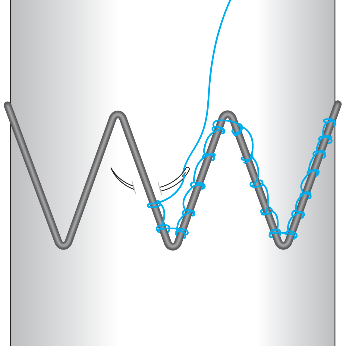 The Art and Science of Sewing in Medical Device Assembly: Innovating ...